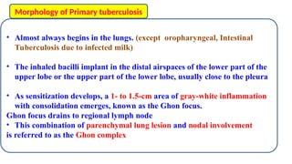 Tuberculosis in Dentistry: Oral Manifestations, Diagnosis, and ...