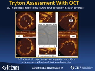 Stent Expansion and Lesion Coverage Insights From Intravascular Imaging ...