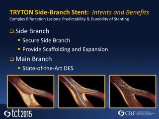 Stent Expansion and Lesion Coverage Insights From Intravascular Imaging | Antonio L. Bartorelli ...