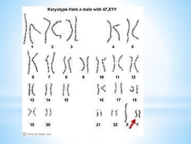 Xyy Chromosome