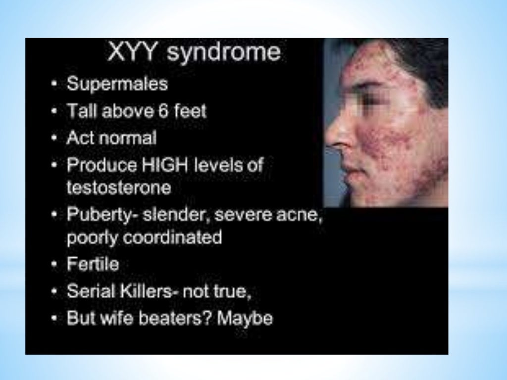 Xyy A Genetic Disorder Xyy A Genetic Disorder