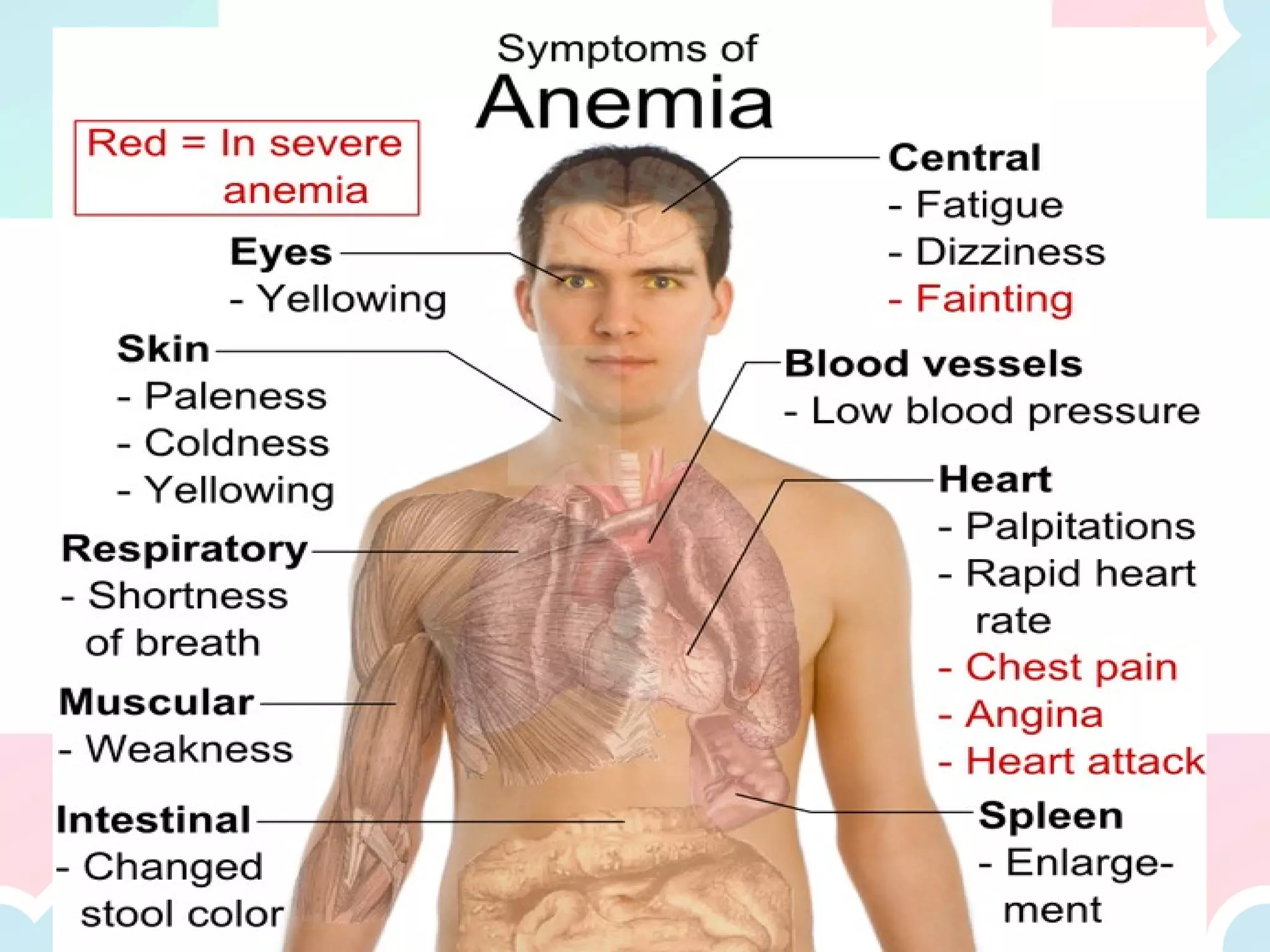 HS-_Iron_Deficiency_Anemia.pdf