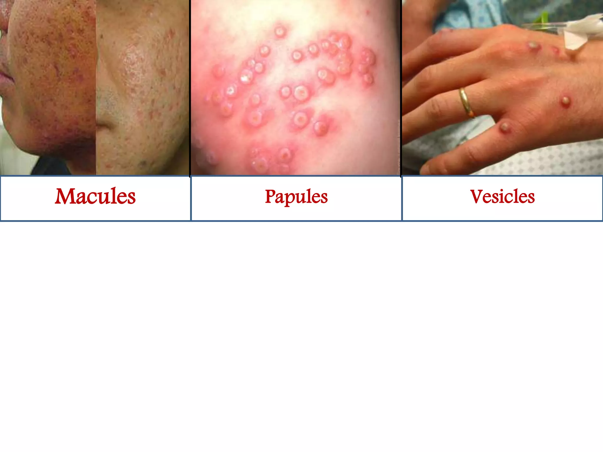 Physical examination | PPTX