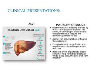 Case presentation on ALD with PORTAL HTN | PPTX | Digestive Disorders ...