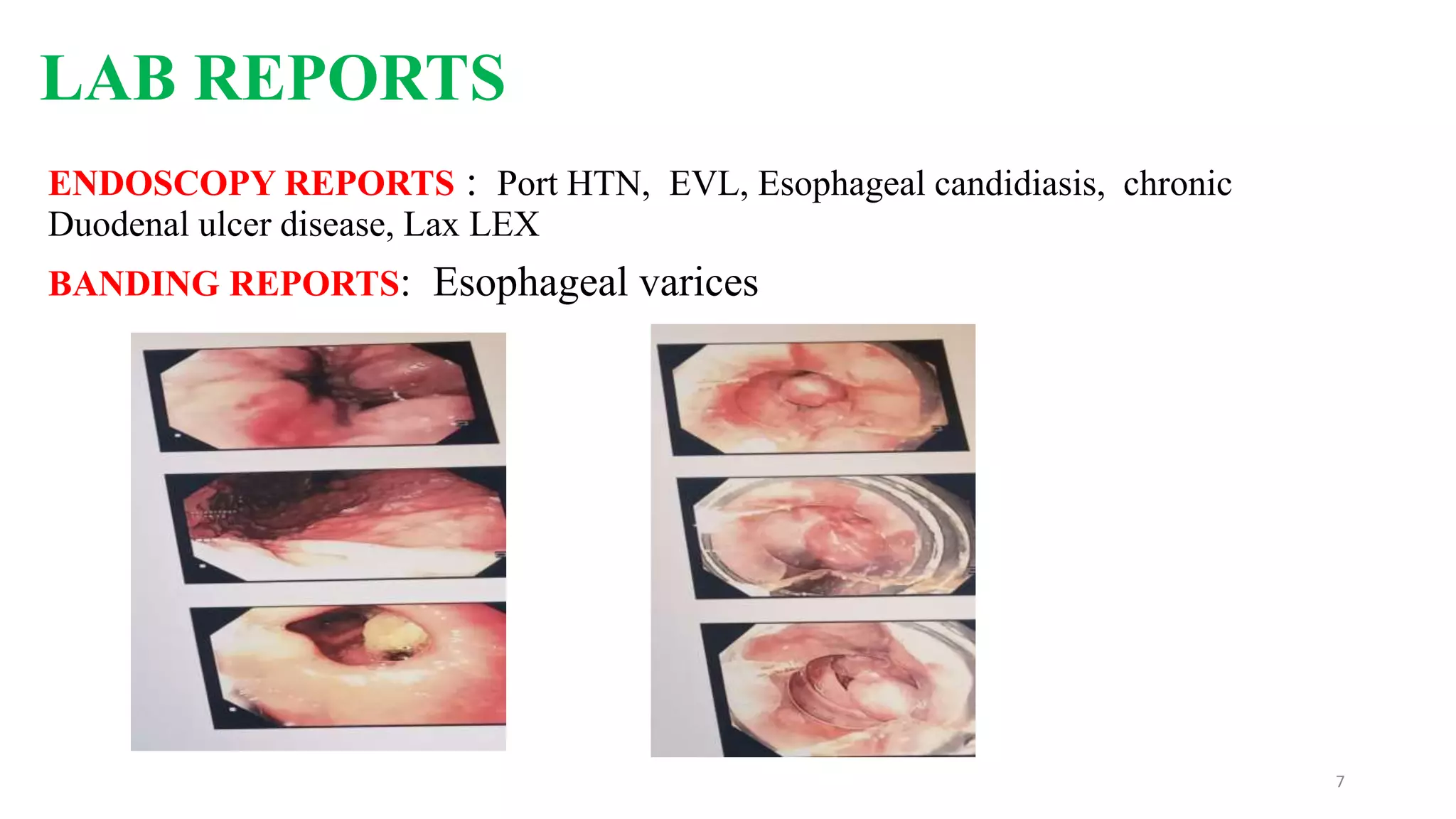 case presentation on esophageal candidiasis & varices | PPTX