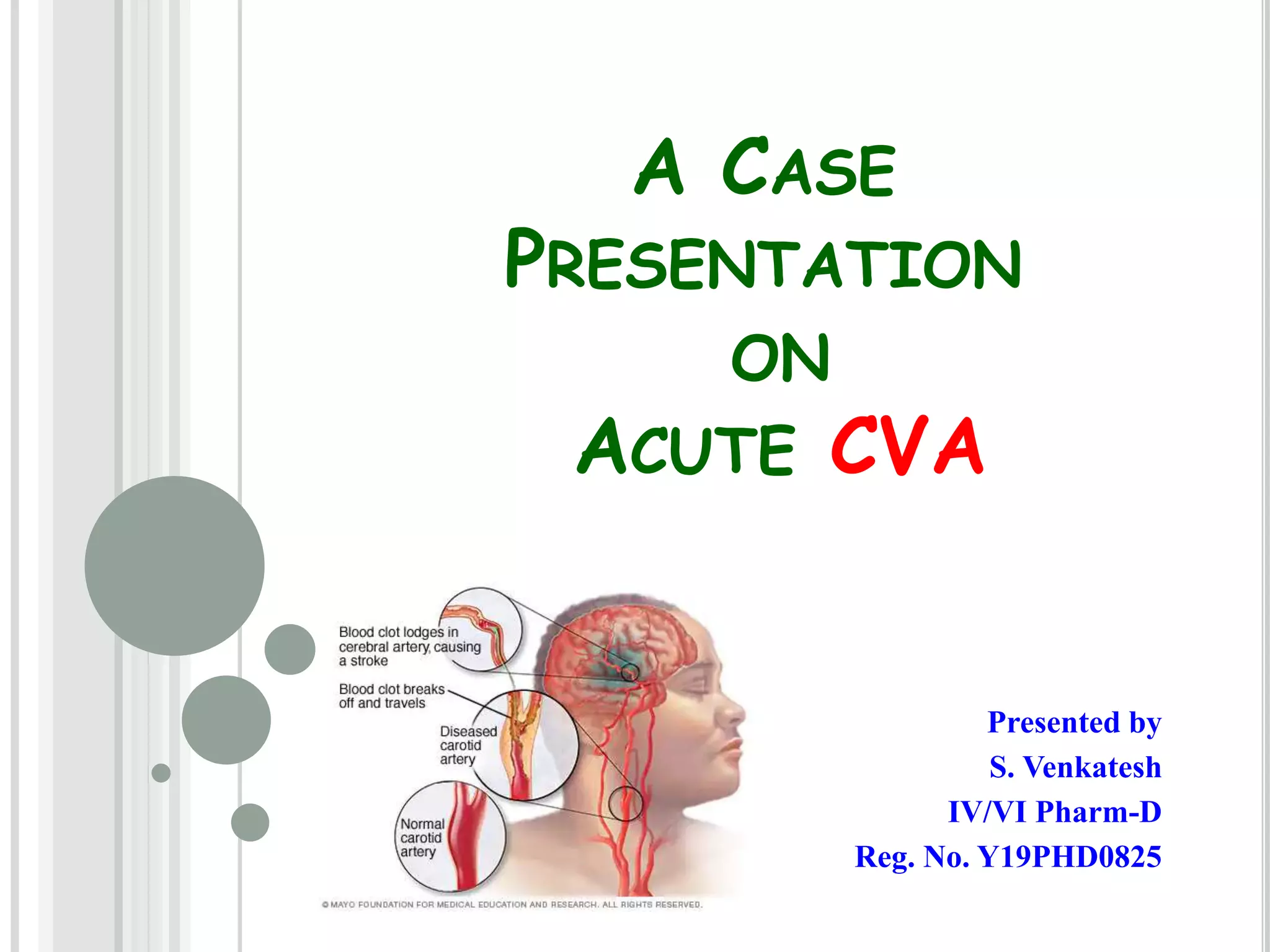 Case presentation on CVA.pptx