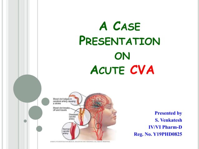 Case presentation on CVA.pptx | Brain and Nervous System Disorders | Diseases and Conditions