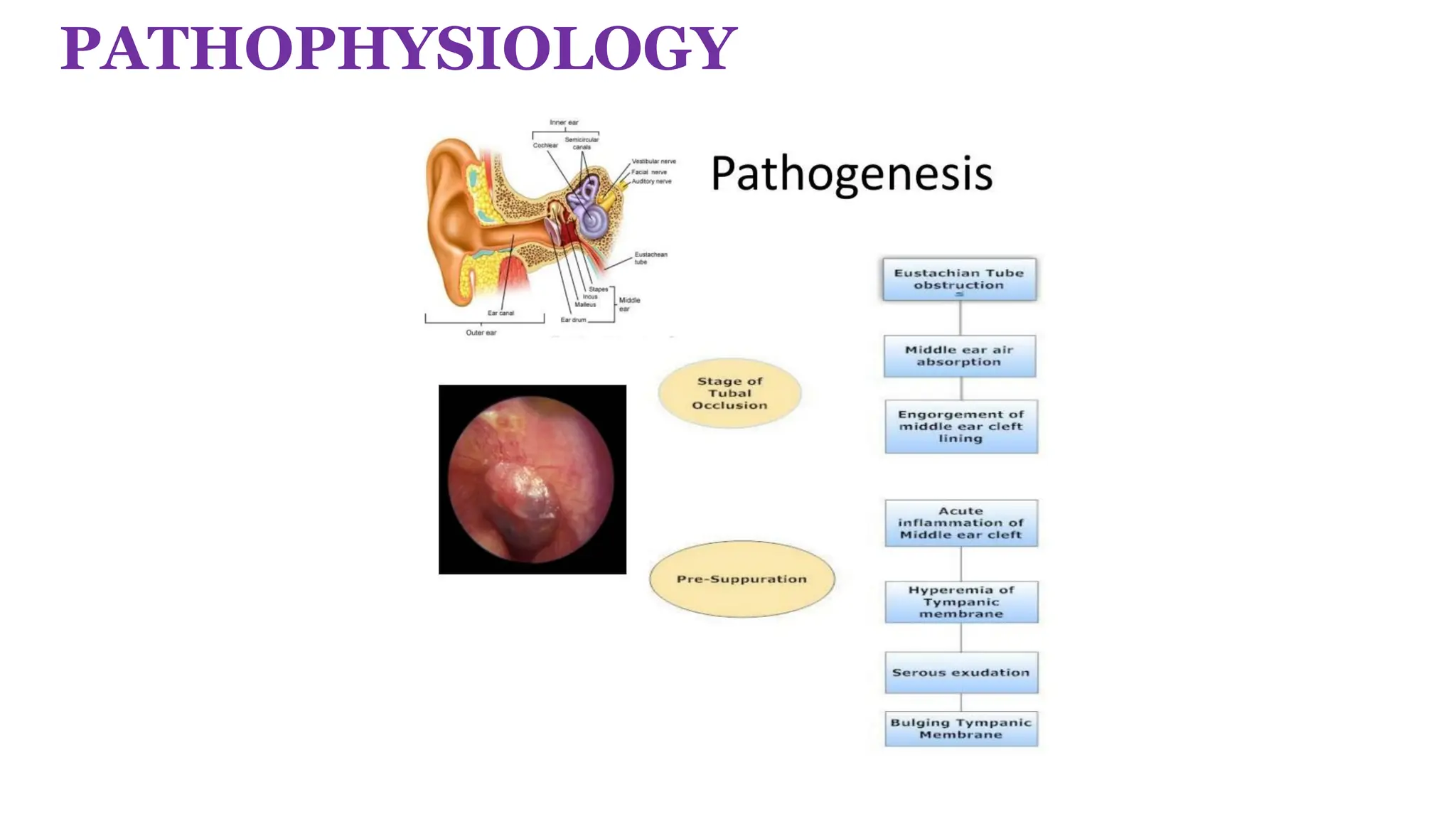 case presentation suppurative otitis media csom | PPTX