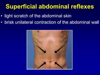 Abdominal Reflex