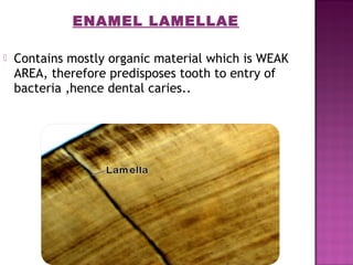 Enamel clinical aspect sagar hiwale | PPT