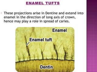 Enamel clinical aspect sagar hiwale | PPT