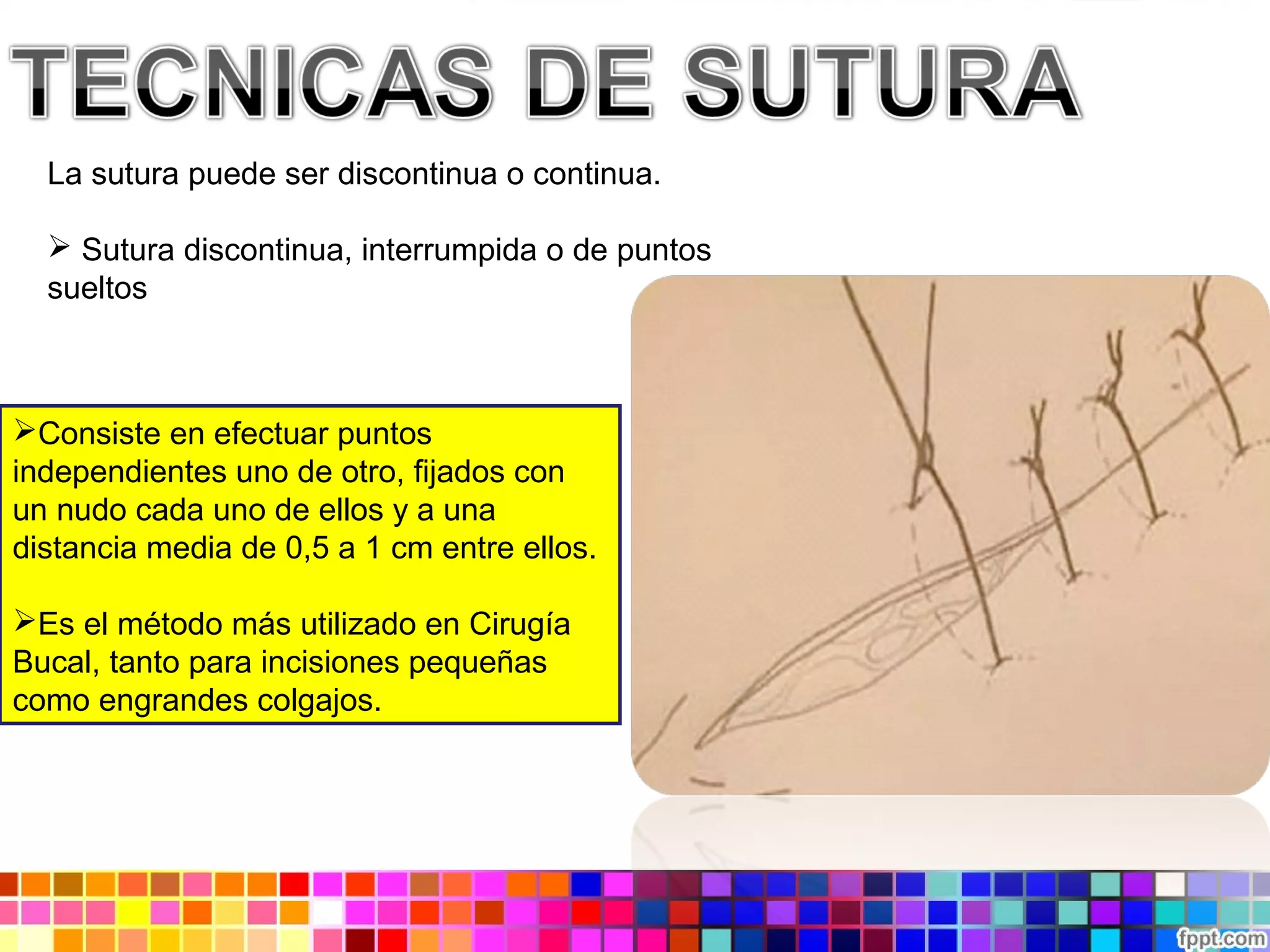 Colgajos y Suturas | PPT