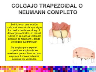Colgajos y Suturas | PPT
