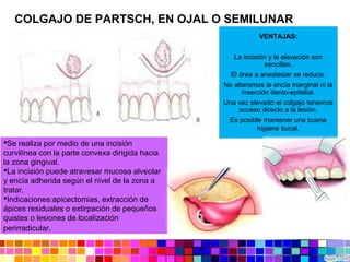 Colgajos y Suturas | PPT