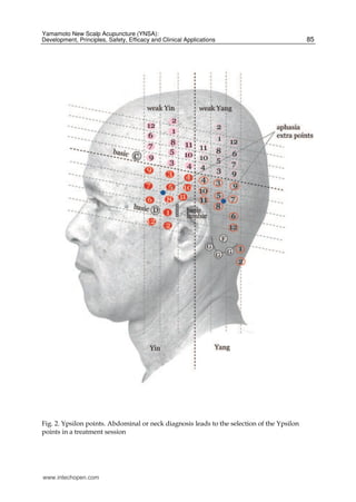 Yamamoto new scalp acupuncture | PDF
