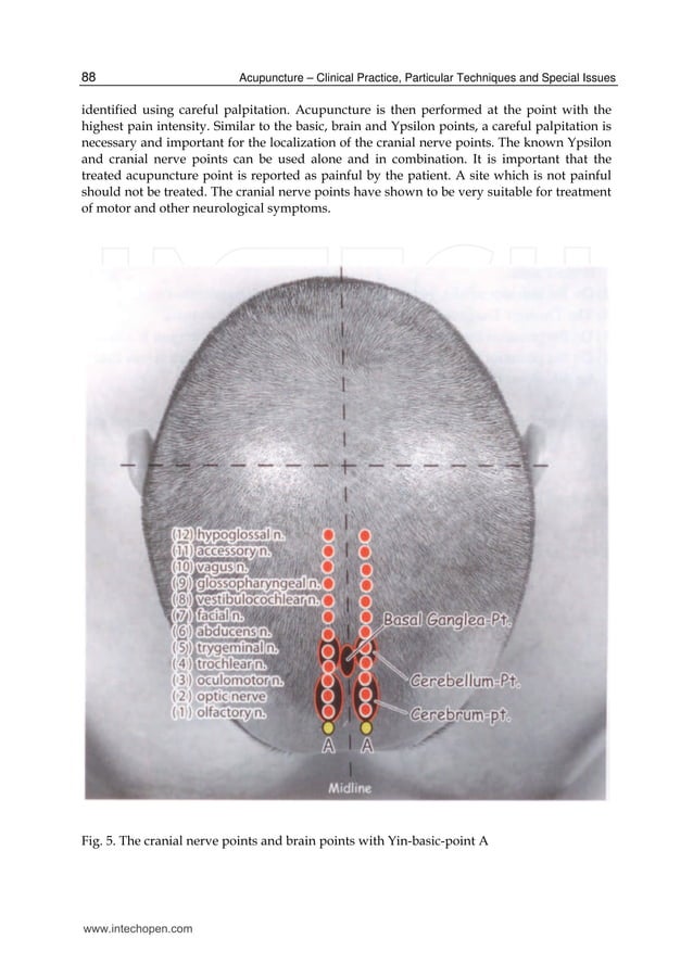 Yamamoto new scalp acupuncture | PDF | Physical Therapy | Wellness