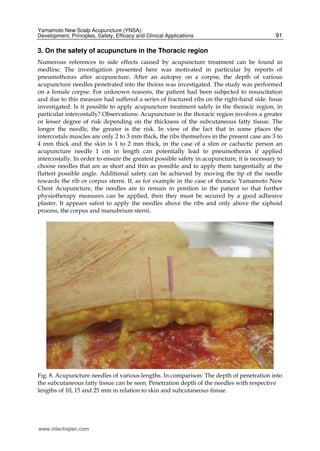 Yamamoto new scalp acupuncture | PDF