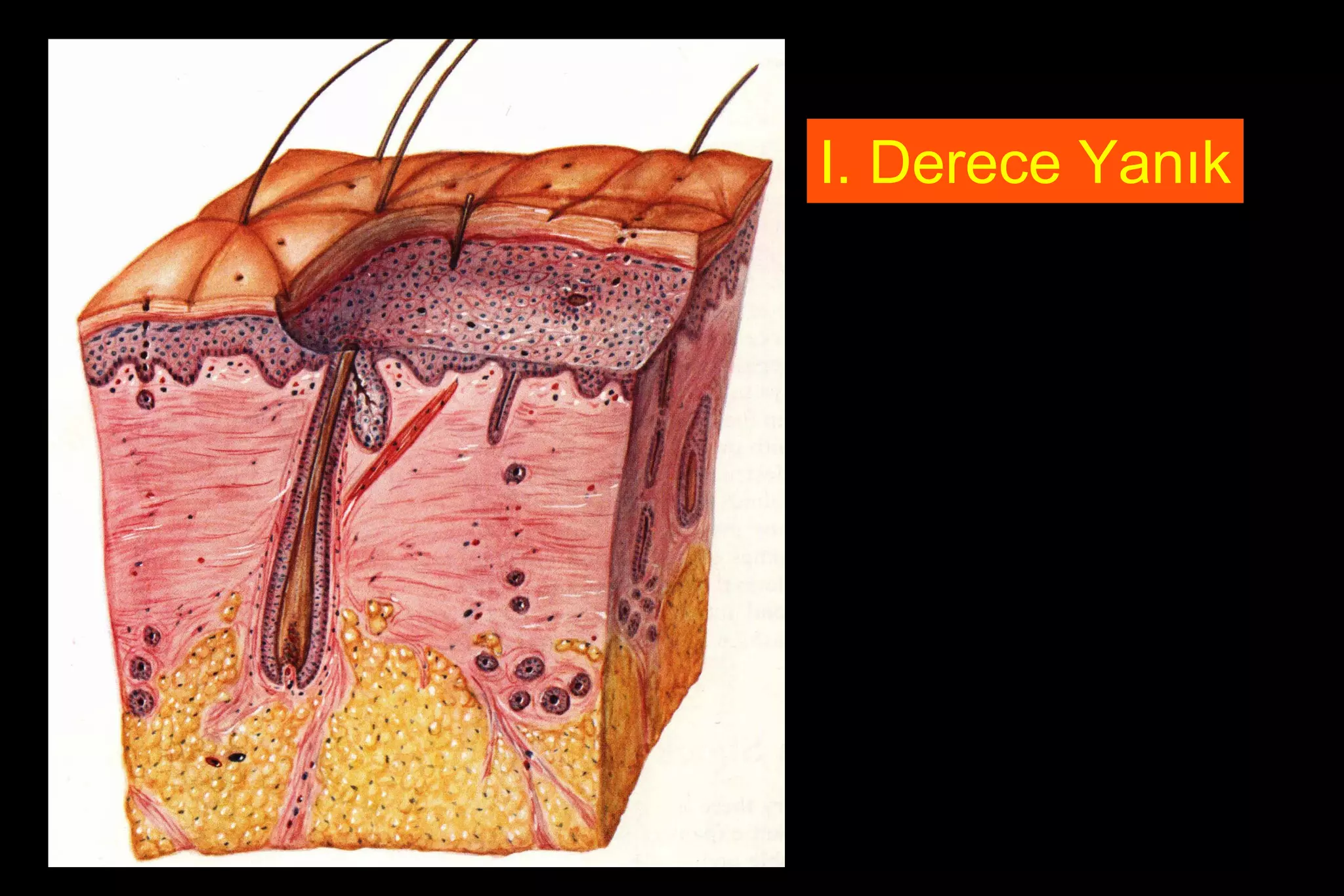Yanik ve tedavisi | PDF