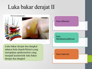 Pharmacy Drug of Choice for Burned Human Skin | PPTX