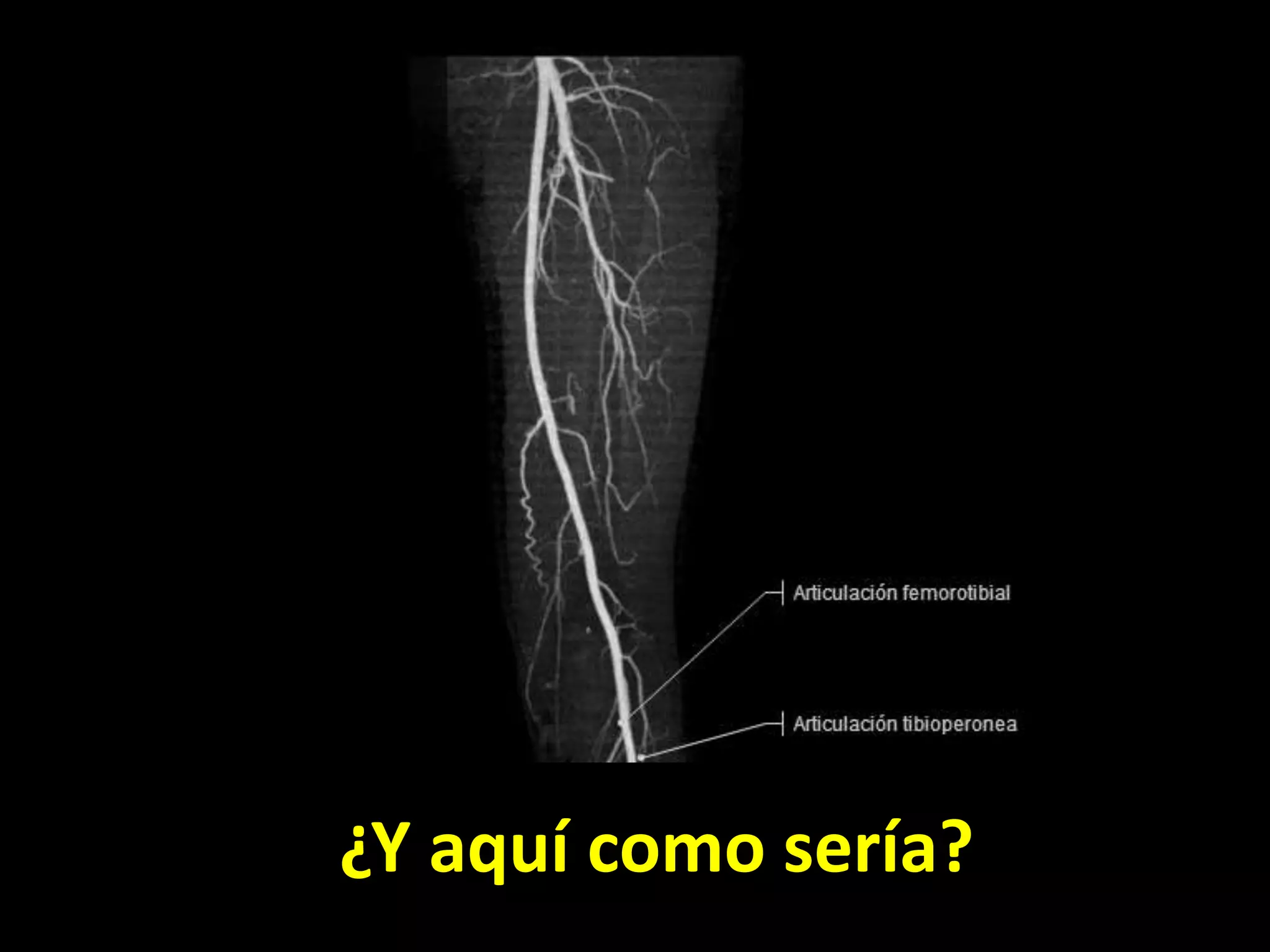 Anatomía Radiológica de las Arterias y Venas del MMII | PPT