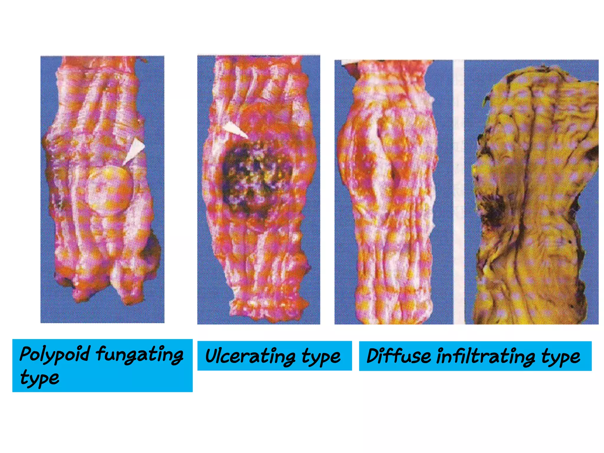 GASTROINTESTINAL PATHOLOGY | PDF