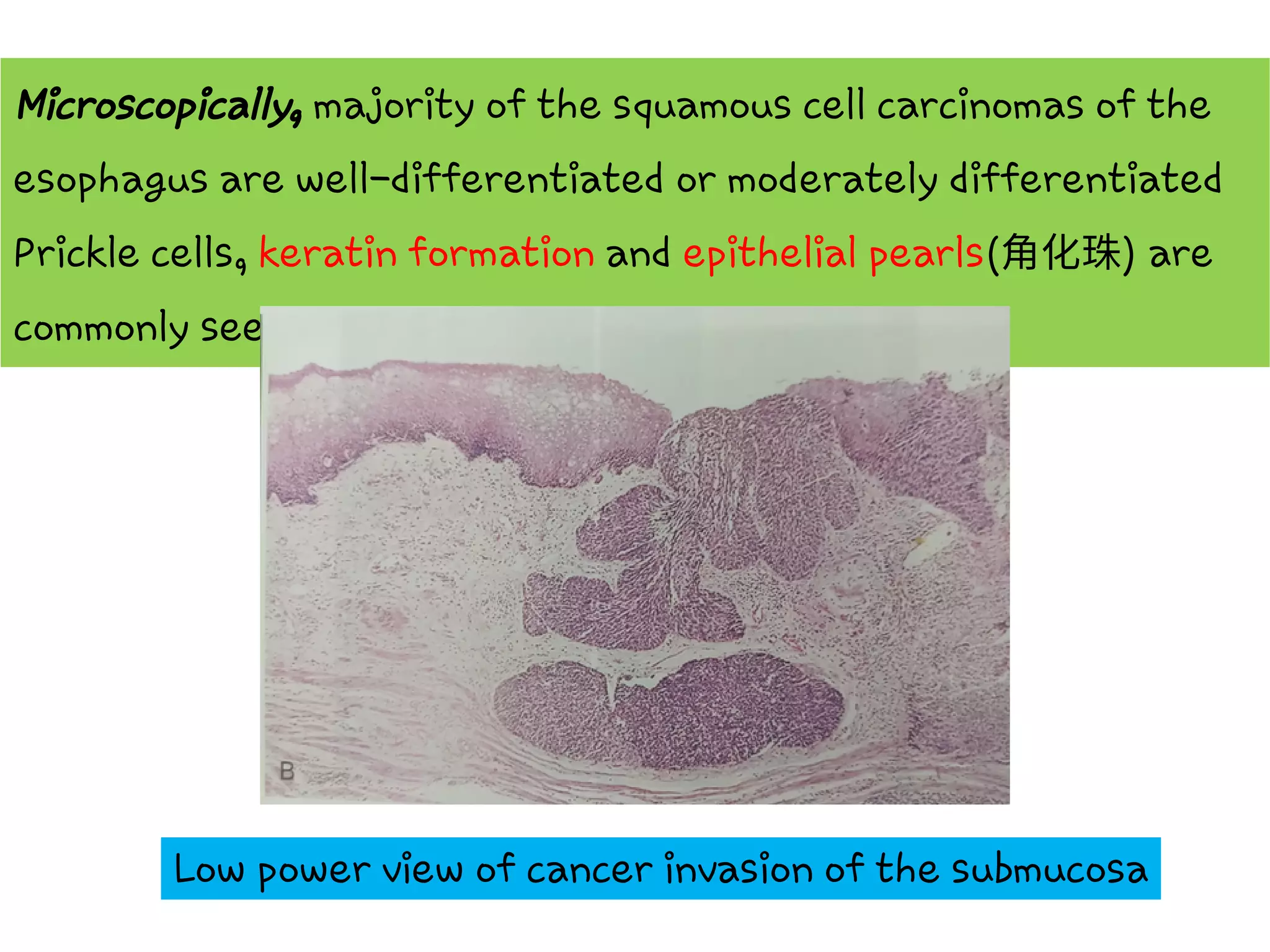 GASTROINTESTINAL PATHOLOGY | PDF