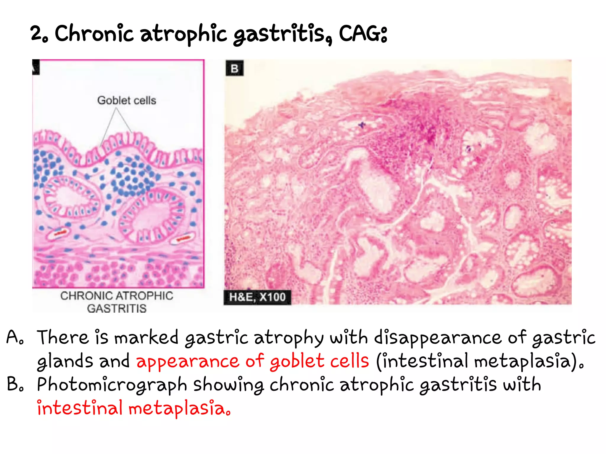 GASTROINTESTINAL PATHOLOGY | PDF
