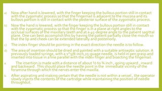 yash_1_.pptx nerve blocks maxillary psa | PPTX