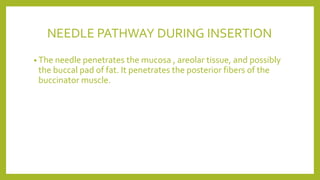 yash_1_.pptx nerve blocks maxillary psa | PPTX