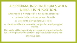 yash_1_.pptx nerve blocks maxillary psa | PPTX