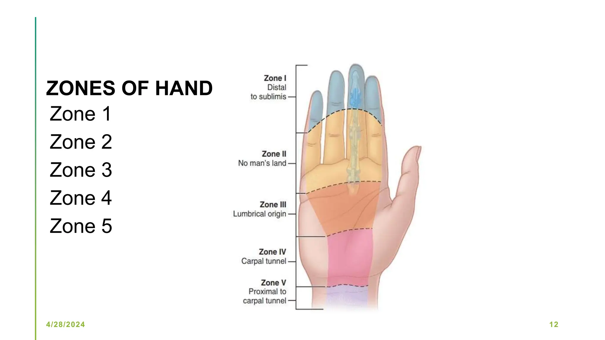 The flexor mechanism of the hand refers to the complex system of ...