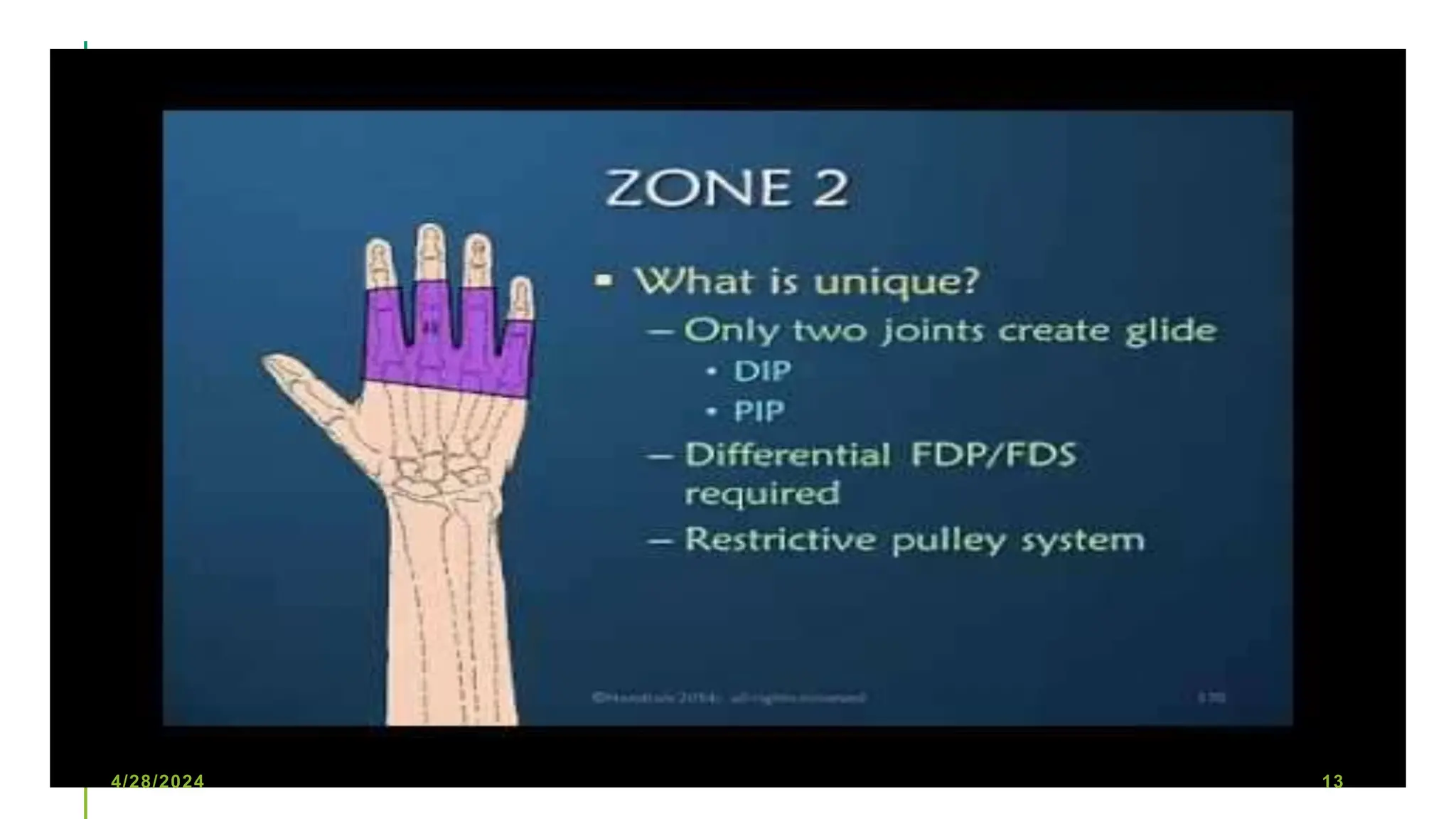 The flexor mechanism of the hand refers to the complex system of ...
