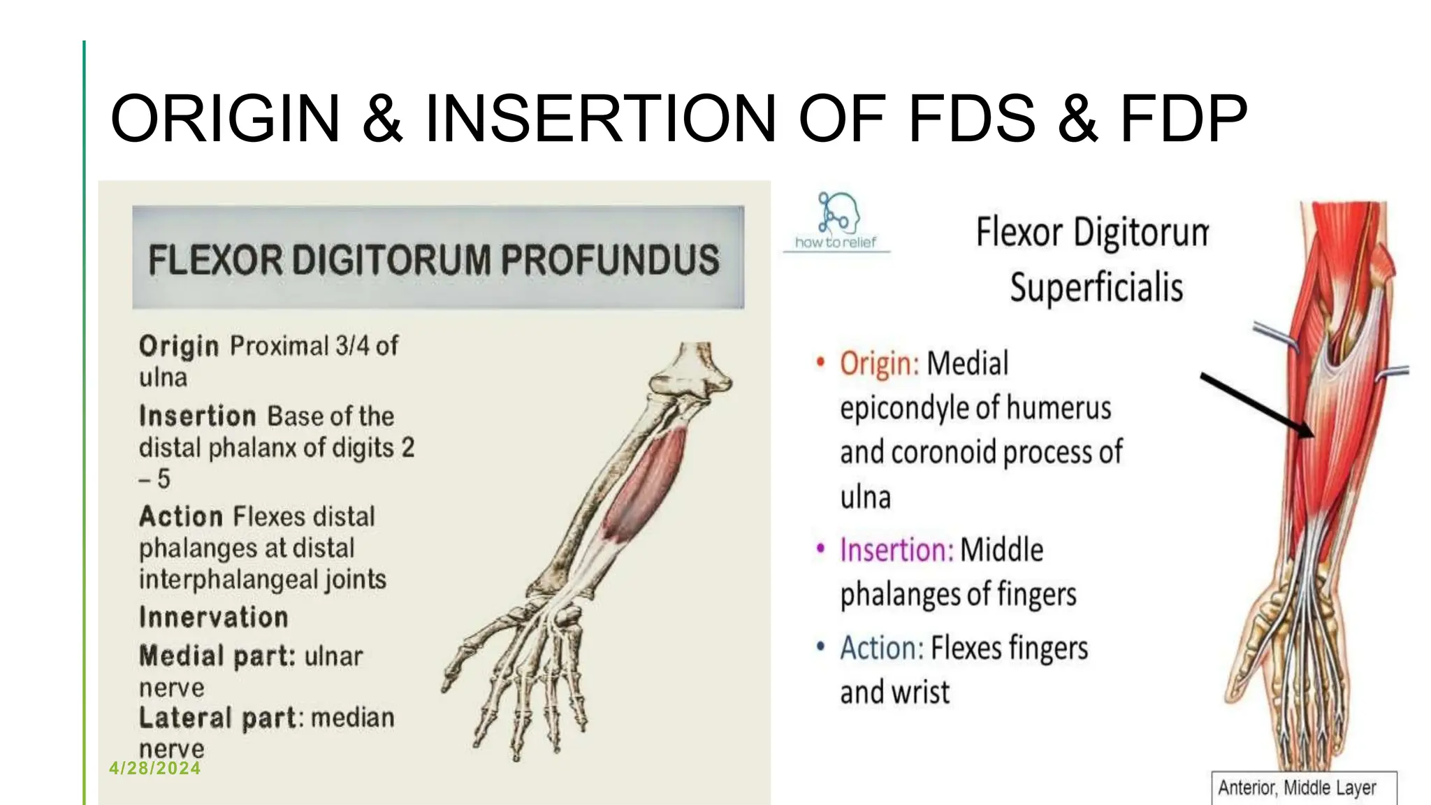 The flexor mechanism of the hand refers to the complex system of ...