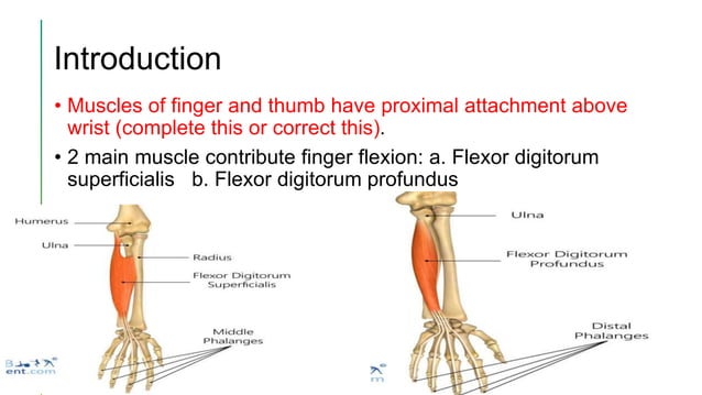The flexor mechanism of the hand refers to the complex system of ...