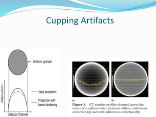 CT Generations and Artefacts | PPT