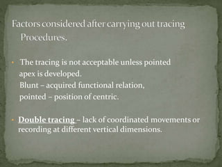 Gothic arch tracers | PPTX