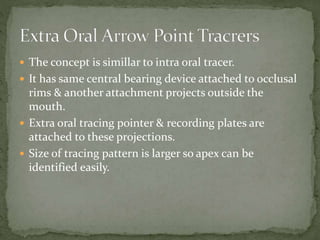 Gothic arch tracers | PPTX