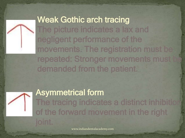 Gothic arch tracers | PPTX | Dental Health | Diseases and Conditions