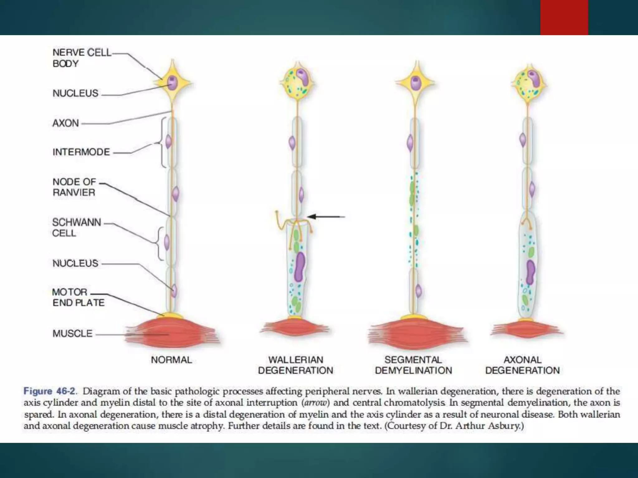peripheral nerve injury concepts and management | PPTX