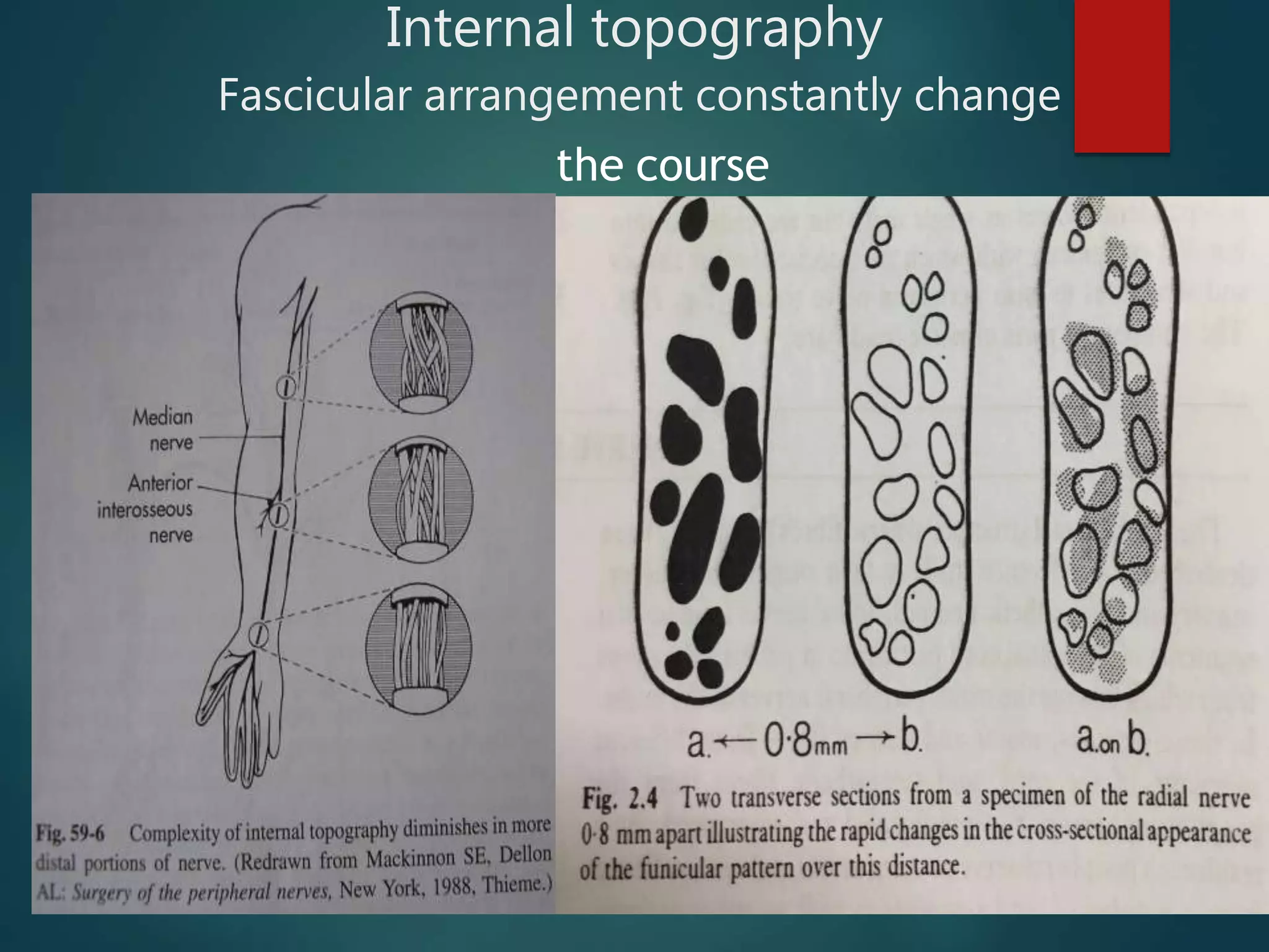 peripheral nerve injury concepts and management | PPTX