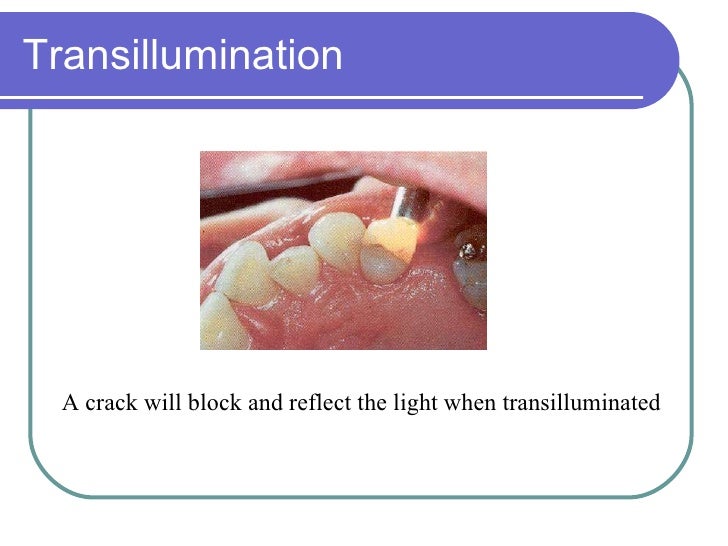 diagnosis and treatment planning