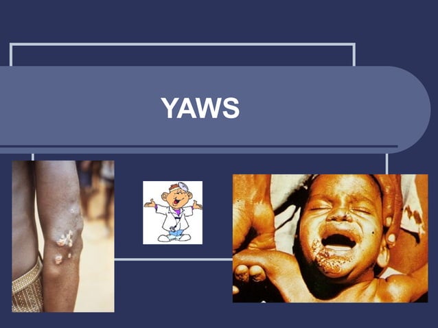 Yaws | PPT | Infectious Diseases | Diseases and Conditions