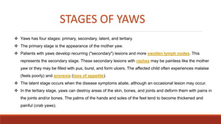 Yaws | PPTX
