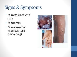 Yaws eradication programme | PPTX