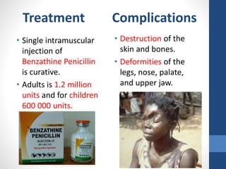 Yaws eradication programme | PPTX