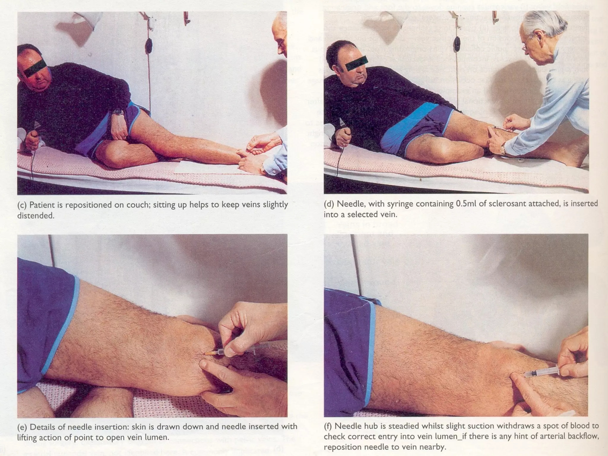 yazh-varicoseveinsurgery-14thoctfinal-170501172742 (1).pdf