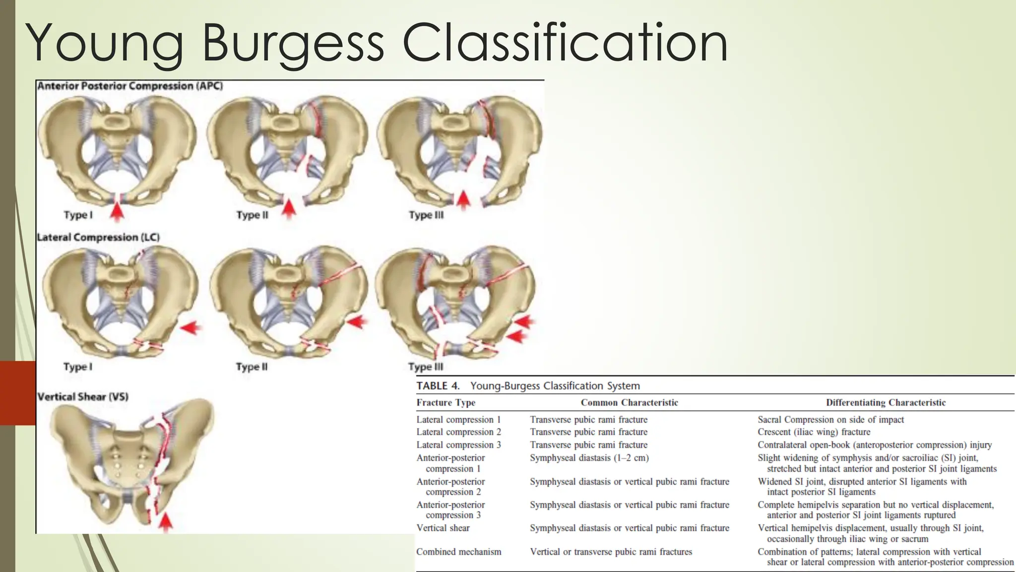 Young Burgess Classification PELVIC KAM.pdf
