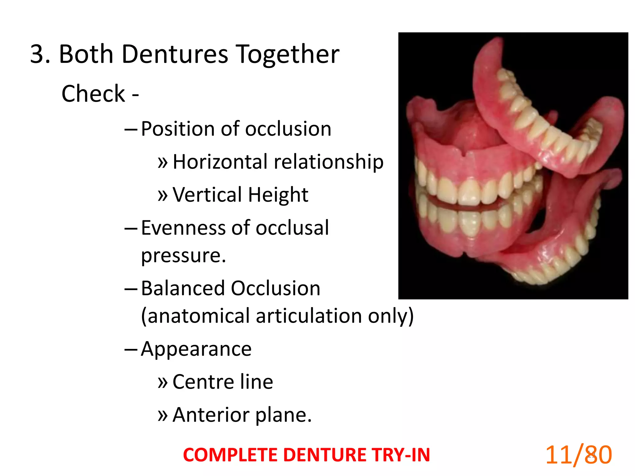 Complete Denture Try In | PPTX