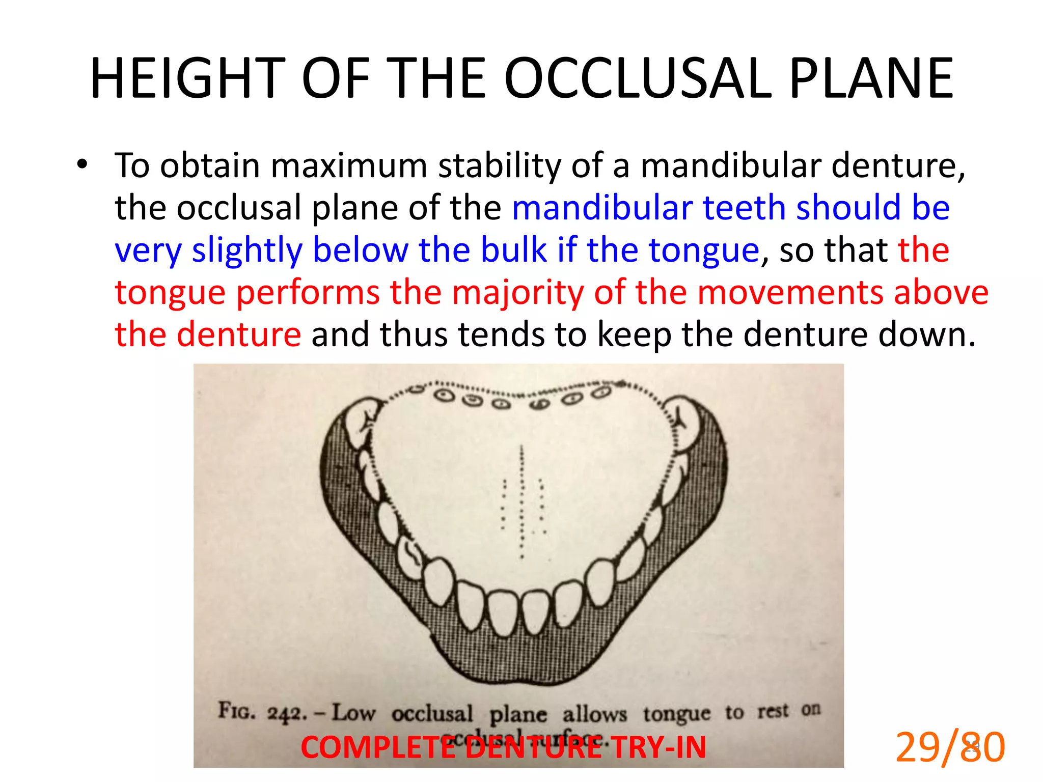 Complete Denture Try In | PPTX