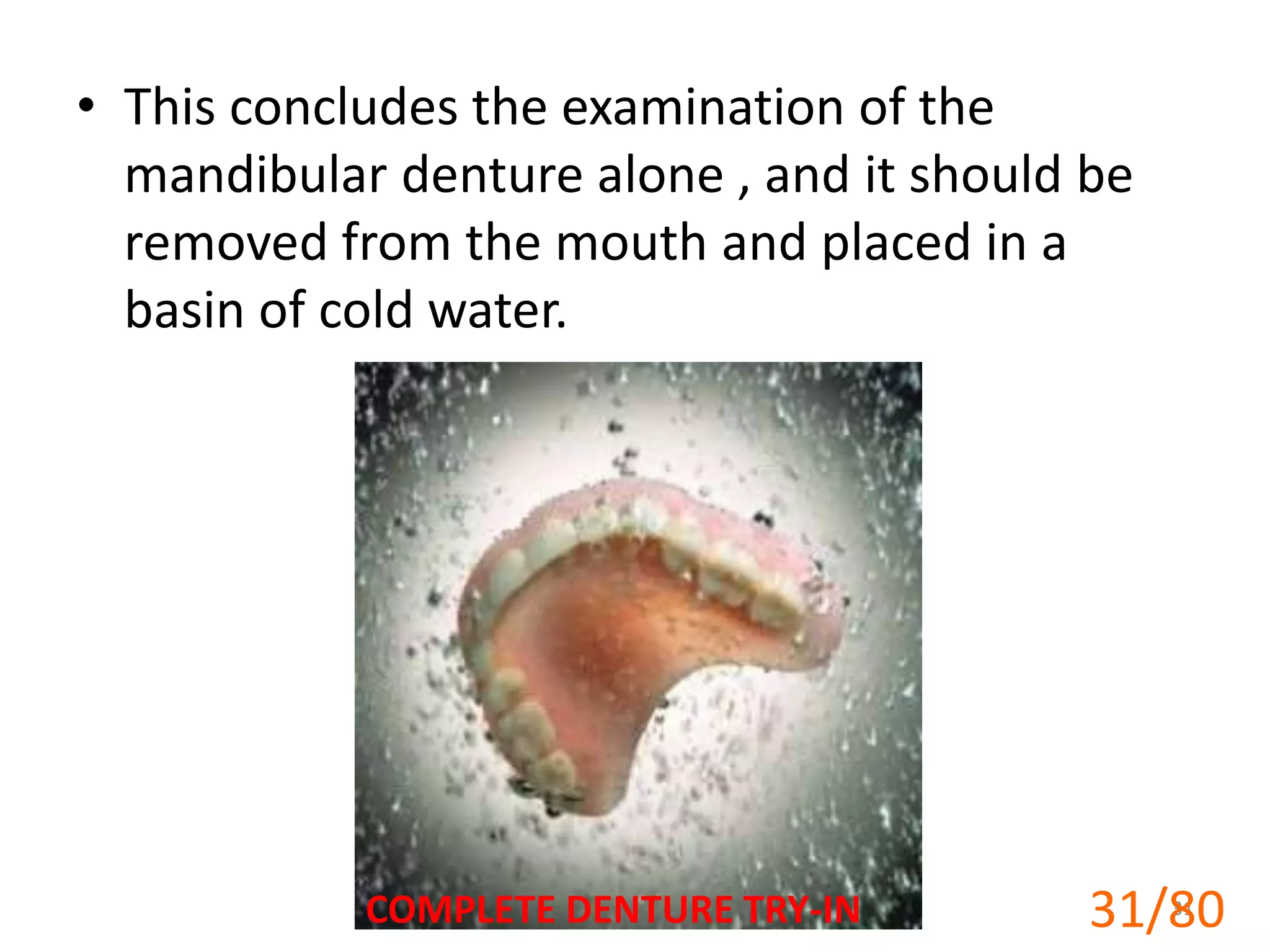 Complete Denture Try In | PPTX